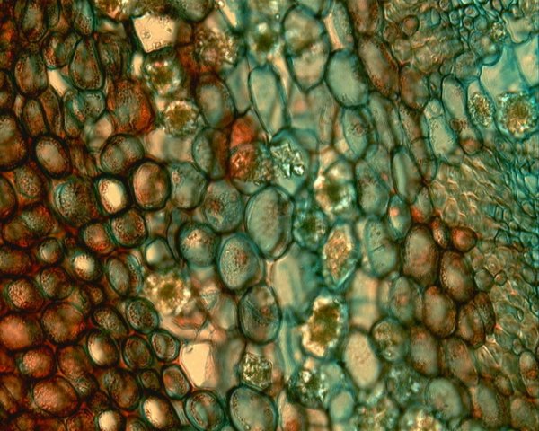 materiel-laboratoire-microscope-dino-lite-dinoeye-camera-oculaire-abemus